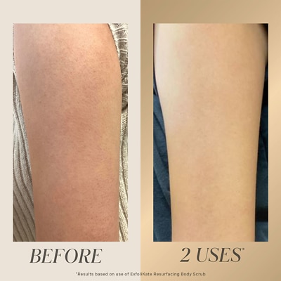 Kate Somerville ExfoliKate™ Resurfacing Body Scrub 150ml | SEPHORA UK